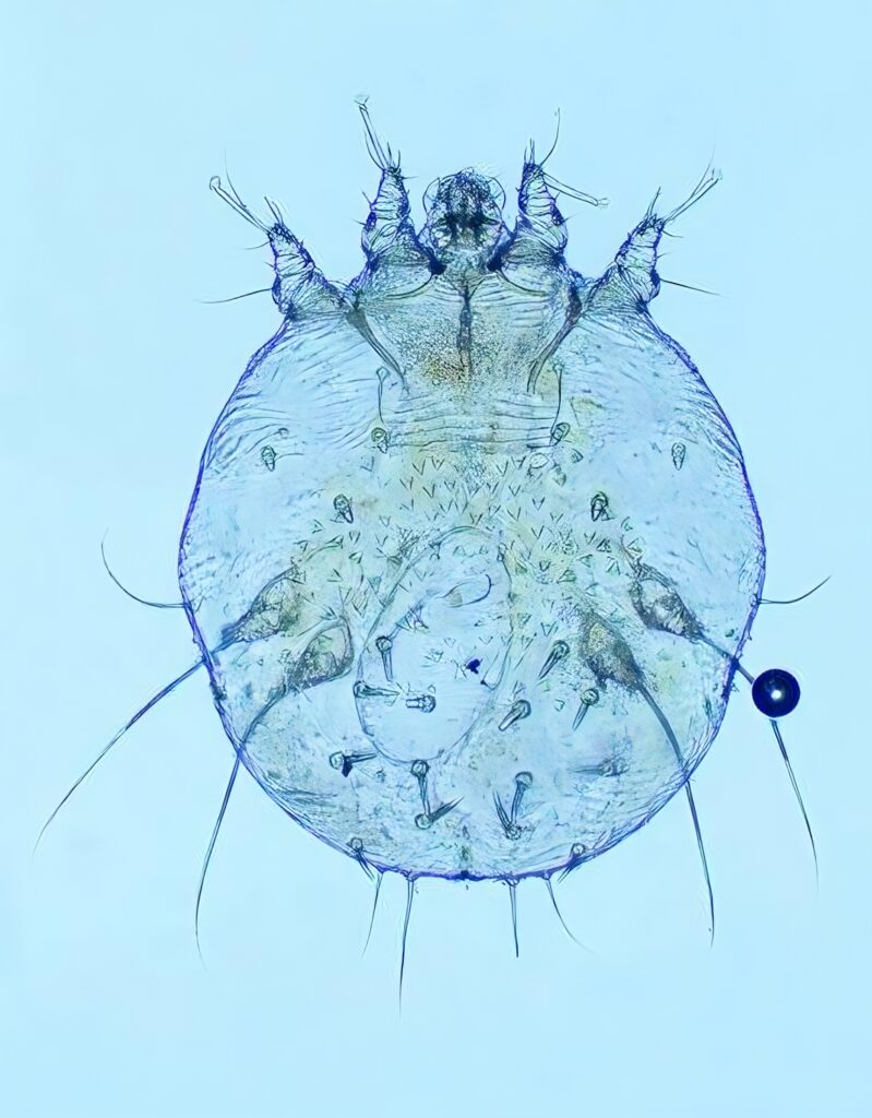 A sensação de ‘bichos na pele’ pode ser imaginária? - Ciência ...